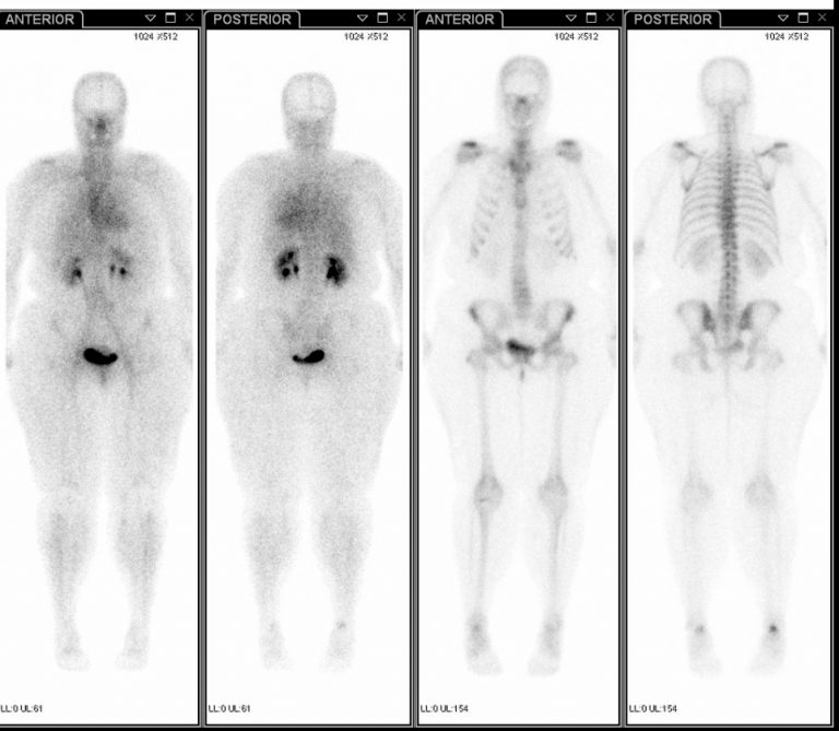 Patienteninformation ⋆ Nuklearmedizin Bamberg Dr. med. Sonja Wedekind